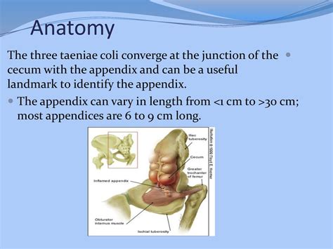 Appendicitis Prof Walid Elshazly Ppt Download