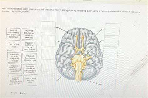 Solved I Ne Labels Describe Signs And Symptoms Of Cranial Nerve