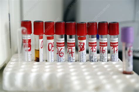 Blood Samples Stock Image C0571218 Science Photo Library