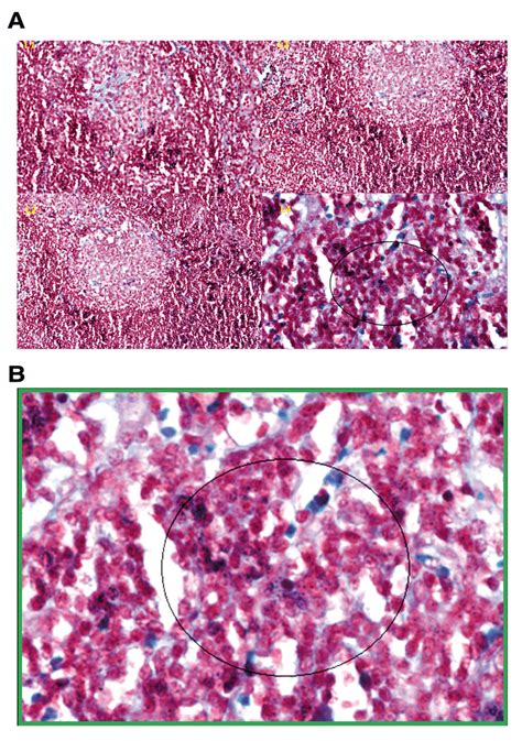 Human Lymph Node Histochemistry A Gram Positive Granules Were Absent Download Scientific
