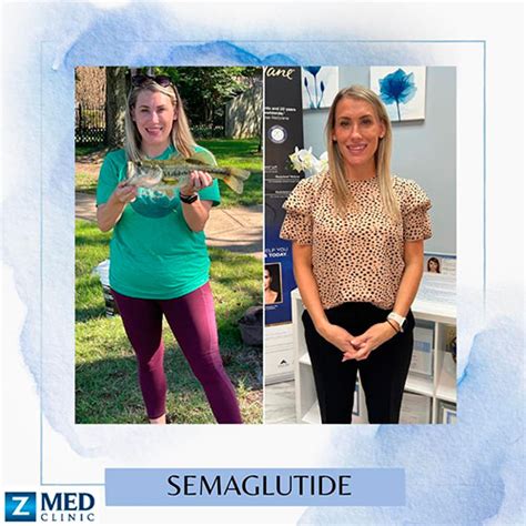 Semaglutide Before And After Photos Weight Loss Results