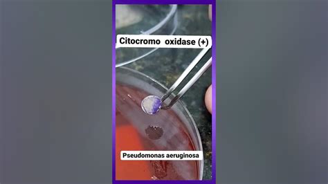 Pseudomanas Bacteria Oxidase Test Youtube
