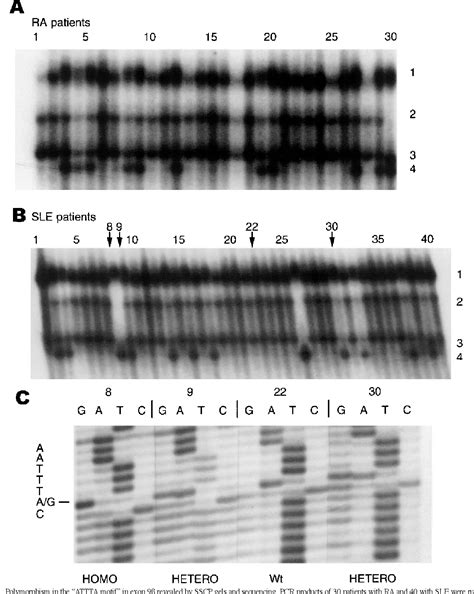 Figure 1 From A Human Glucocorticoid Receptor Gene Variant That