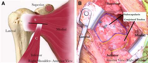 A A Illustrative Representation Of The Right Shoulder Anatomy