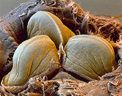 Coloured Sem Of The Teeth Of A Medicinal Leech Stock Image Z205