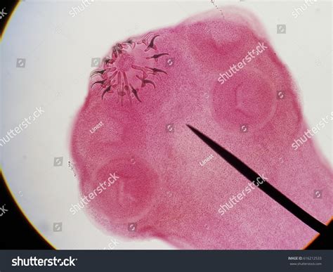 Taenia Solium Scolex Cestodes Taenia Solium Pork Tapeworm Life
