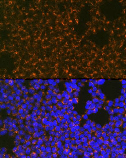 Ccr8 Recombinant Monoclonal Antibody 9n1y1 Ma5 35476