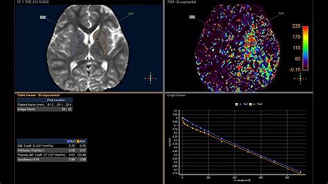 Application Browser Magnetic Resonance Philips