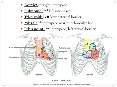 Erb S Point Location At Zane Pellot Blog