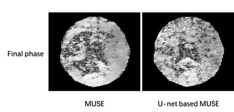 Fig The Improved Phase Estimation Of U Netbased MUSE