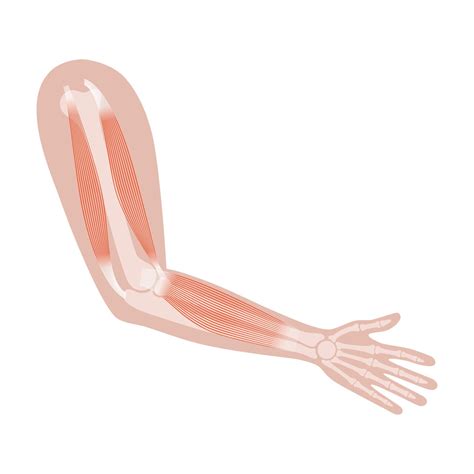 Epicondilite Lateral