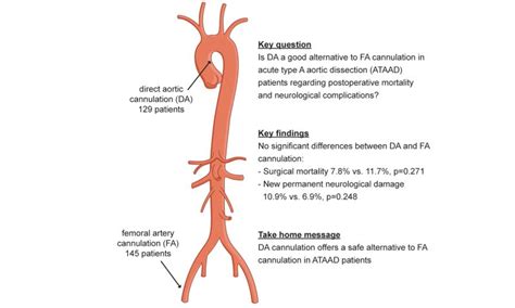 Cannulation Artery Dissection Rachel Ann