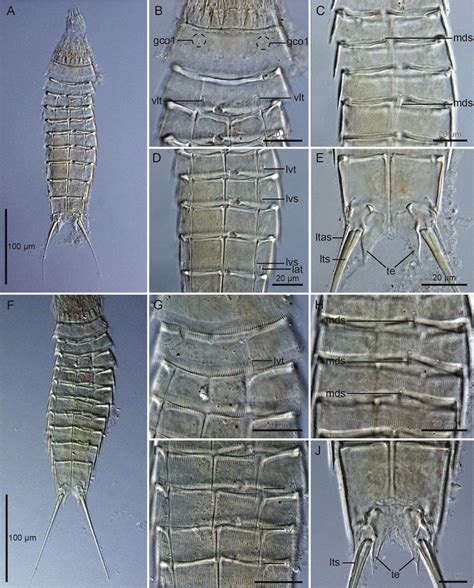 Light Micrographs Showing Overviews And Details Of Trunk Morphology In