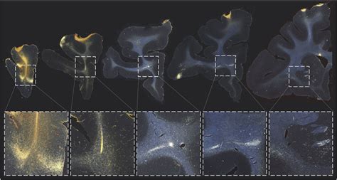 Injection In The Frontopolar Cortex Photomicrographs On The Top Row