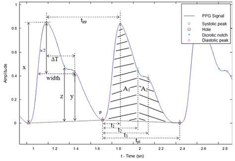 The Characteristic Features Of Ppg Signal In Time Domain [reşit Download Scientific Diagram