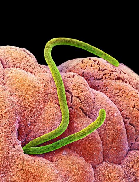 Threadworms In The Gut Sem Photograph By Science Photo Library