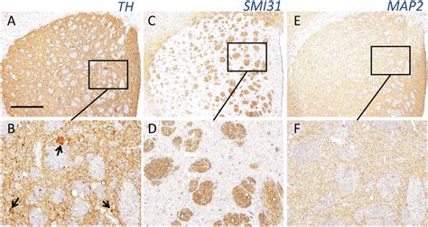 Immunohistochemical Analyses Of Th Smi31 And Map2 In The Striatum