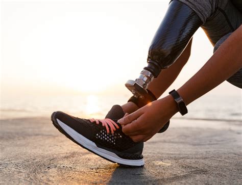 Prosthesis An Overview Of Types Benefits And Challenges Prosthetic