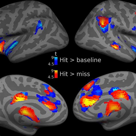Spatial Distribution Of Evoked Cortical Responses During Successful