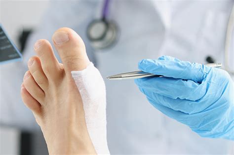 What Is A Pinprick Test During A Neuropathy Foot Exam