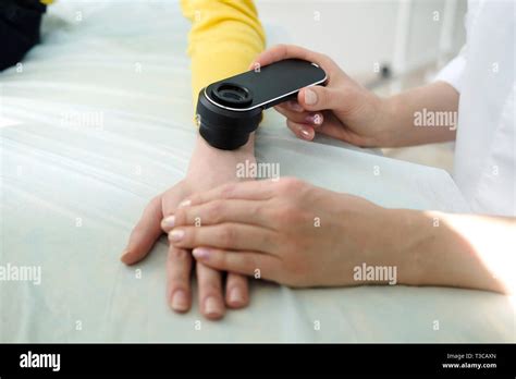 Female Dermatologist Using A Professional Dermatoscope While Doing Skin