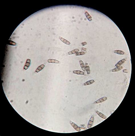 Pestalotiopsis Microspora Pestalotiopsis Microspora Picture Mushroom
