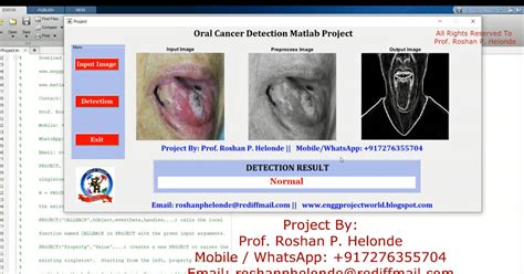 Oral Cancer Detection Using Image Processing Oral Cancer Detection