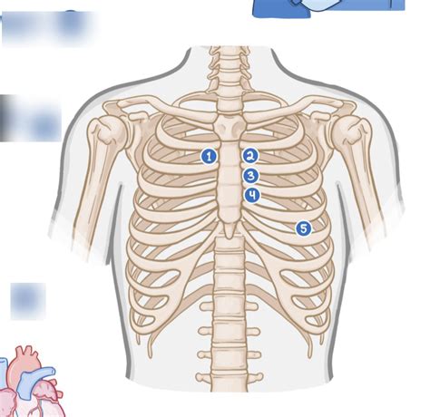 Heart Valve Auscultation Diagram At Ernie Gill Blog