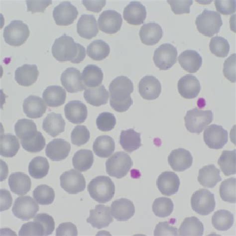 Osmotic Gradient Ektacytometry Oge Profile Osmoscan Curve Measured Download Scientific
