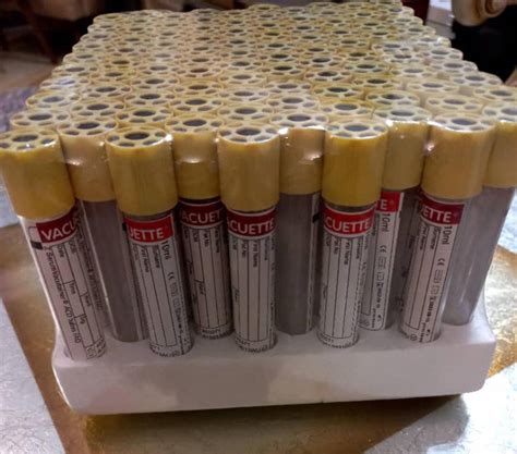 لوله کیت پی آر پی Prp فروشگاه اینترنتی تجهیزات و لوزام پزشکی آسان مد