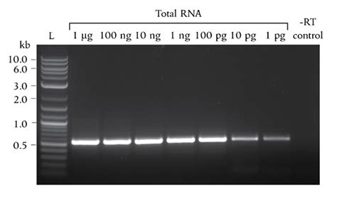 Reverse Transcriptases Neb