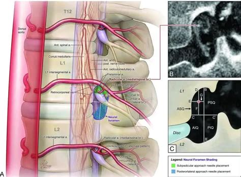 Венозен сплит Речник на медицинските термини Медицински термини