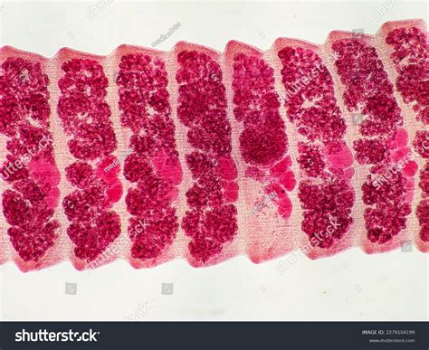 Hymenolepis Nana Proglottid