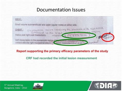 Investigator Site Audits And Gcp Compliance Shehnaz V2 0 Pptx