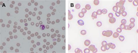 Babesia In North America Veterinary Clinics Small Animal Practice