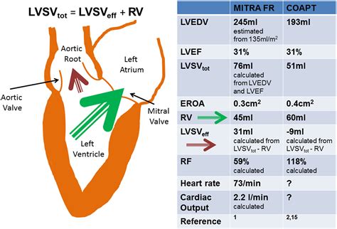 Assessing Functional Mitral Regurgitation With Exercise
