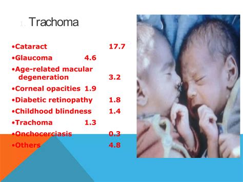 Trachoma Ppt
