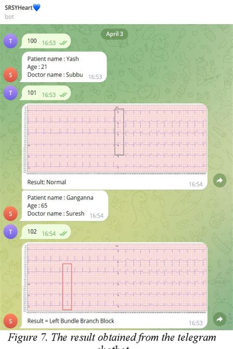 Figure 7 From Classification Of Ecg Arrhythmia Using A Convolution Neural Network Semantic Scholar