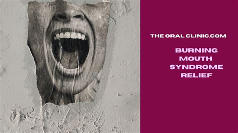 Best Toothpaste For Burning Mouth Syndrome Relief Is Possible