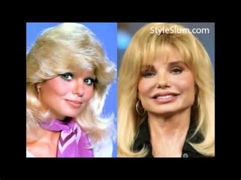 Loni Anderson Plastic Surgery Before And After Photos Youtube