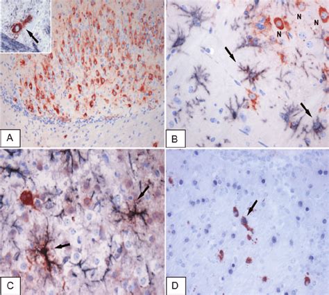 Mhv Infection In Different Cell Types In The Brains Of Ceacam1a Ϫ Ϫ Download Scientific
