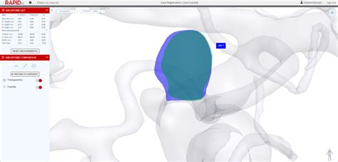 Pushing The Boundaries Of Cerebral Aneurysm Detection Monitoring And