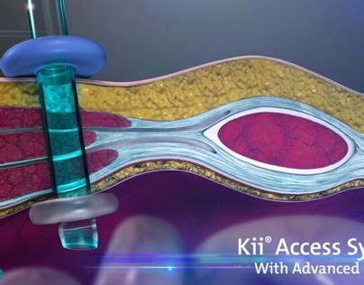 Cross Section Medical Projects Photos Videos Logos Illustrations