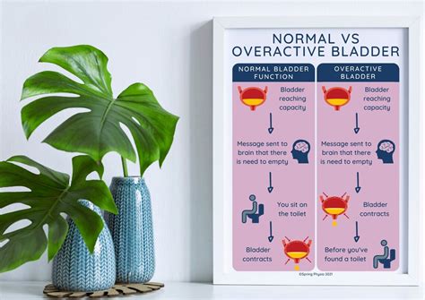 Bladder Poster Pelvic Floor Poster Bladder Art Pelvic Etsy