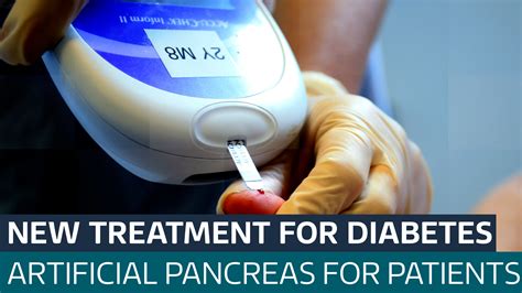 New Treatment For Type 1 Diabetes As Patients Offered Artificial