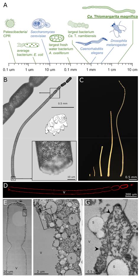 Largest Bacterium Ever Discovered Has An Unexpectedly Complex Samim