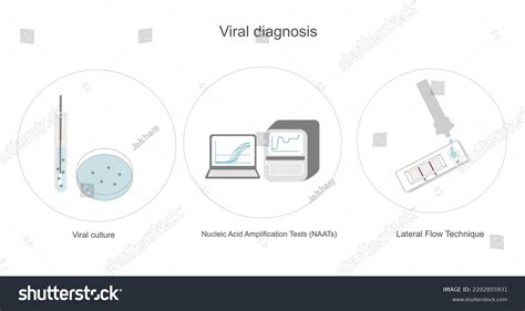 Viral Detection Identification Infectious Diagnosis That Stock Vector Royalty Free 2202855931