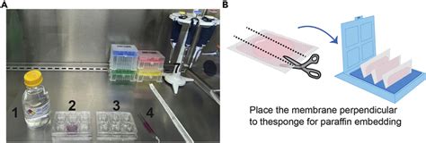Membrane Fixation And Embedding A Materials For Membrane Fixation And
