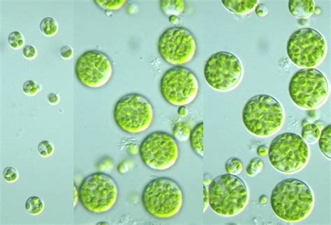 Heterokontophyta Xanthophyceae Mischococcales