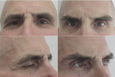 Dott Stefano Bezzi Guidaestetica It